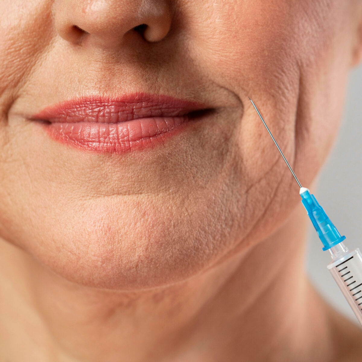 Filling treatment - DrD Plastic Surgery